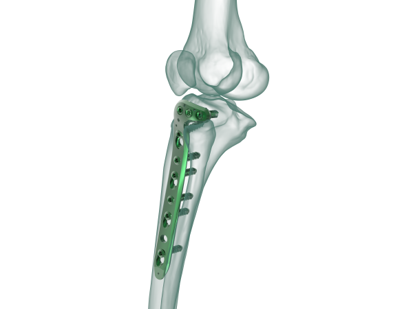 Products | TRUEMED Medikal